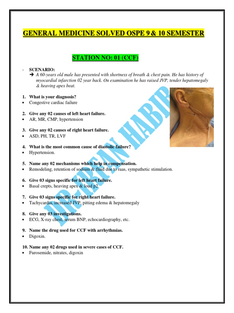 General Medicine Solved Ospe | PDF | Myocardial Infarction | Anemia