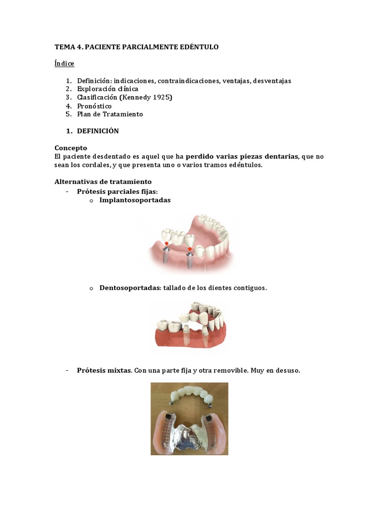 Tema 4. Paciente Parcialmente Edéntulo | PDF | Dentadura postiza ...