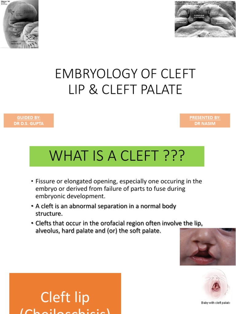 Embryology of Cleft Lip & Cleft Palate | PDF | Human Head And Neck ...