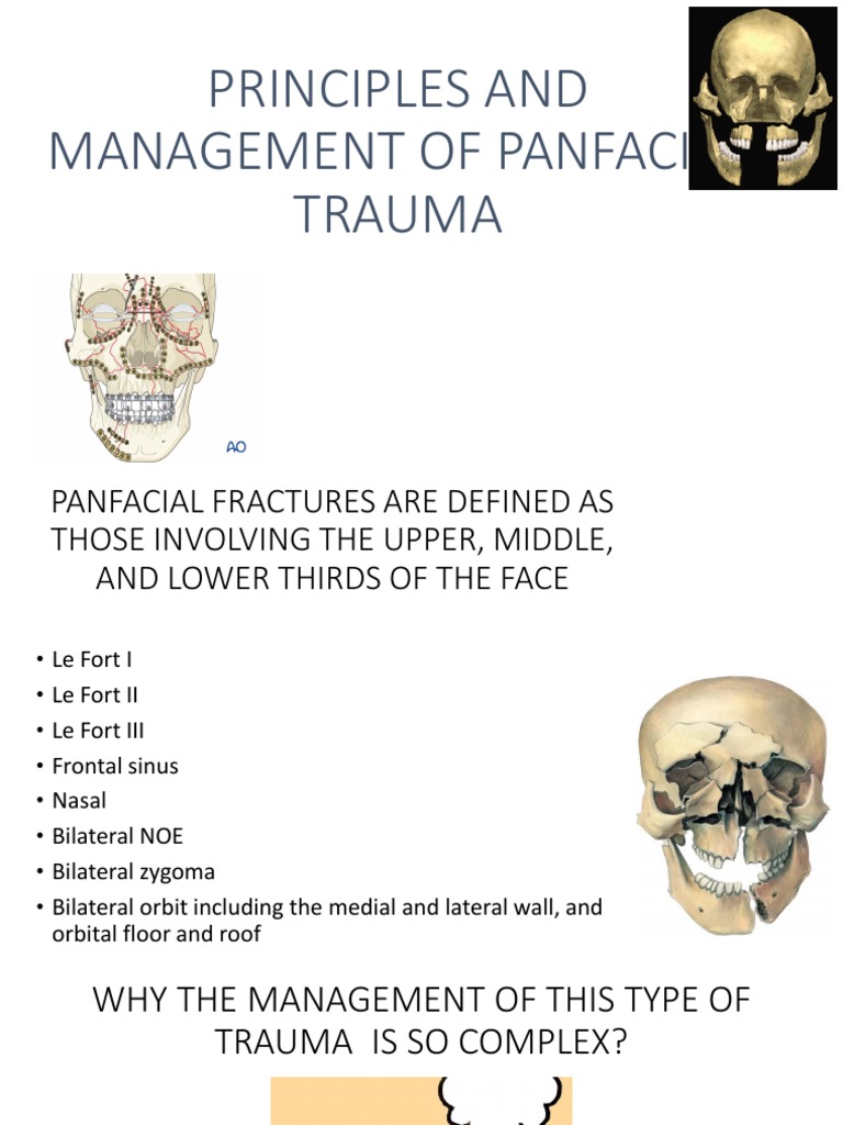 Management of Panfacial Trauma | PDF | Human Anatomy | Human Head And Neck