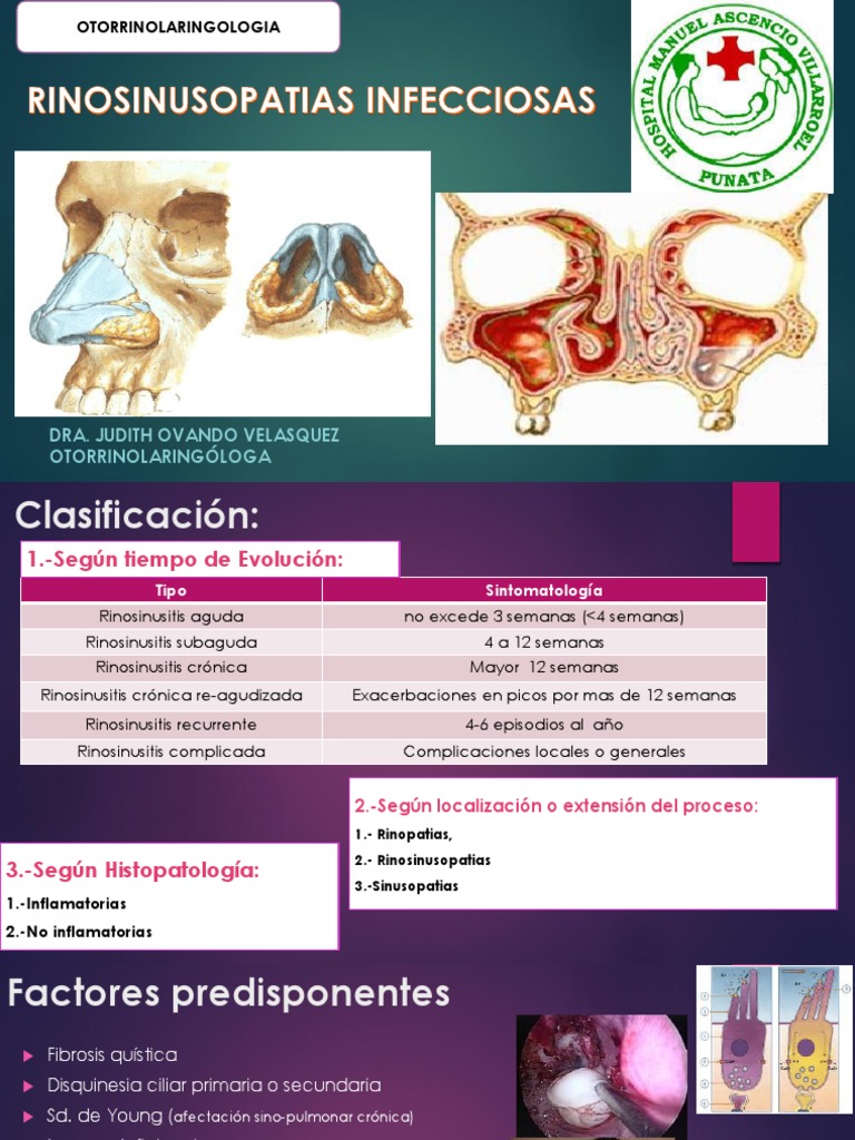 Rinosinusitis Aguda: Clasificación y Tratamiento | PDF | Medicina CLINICA | Ciencias de la Salud