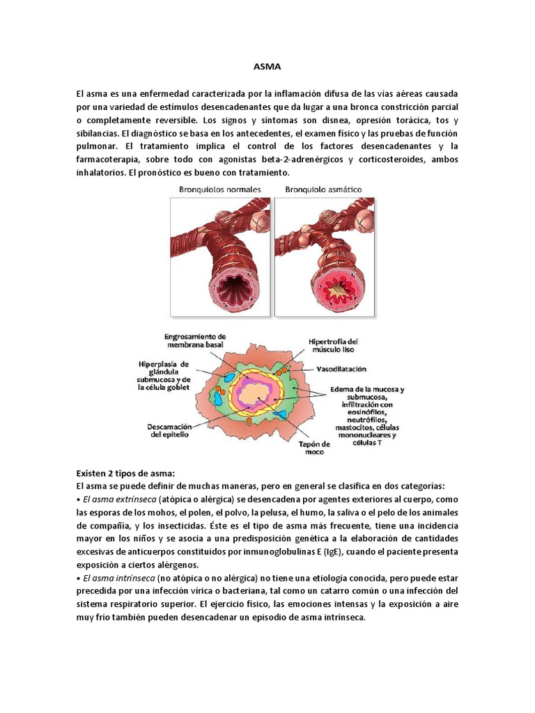 Tipos y tratamiento del asma | PDF | Asma | Alergia