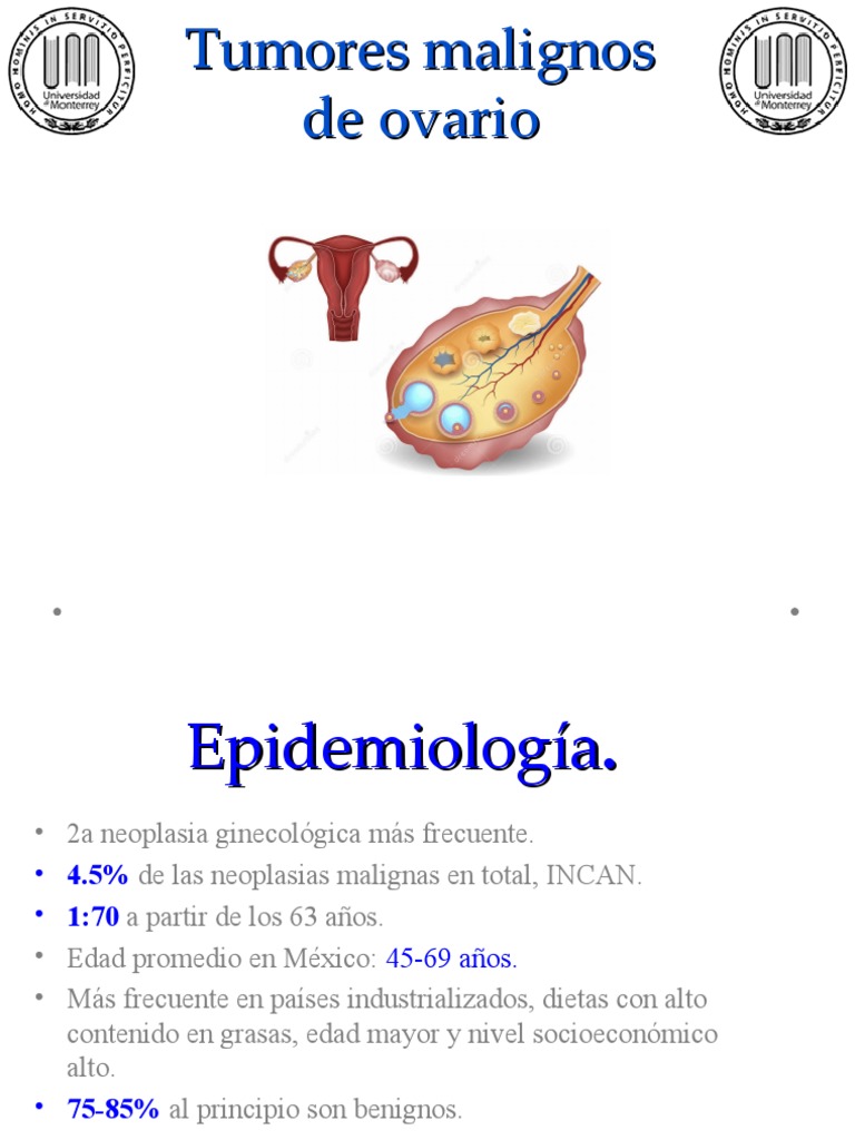 Tumores Malignos Ovarios UDEM OT 19 | PDF | Ovario | Cáncer de ovarios