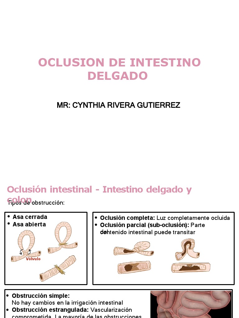 Obstruccion Intestinal | PDF | Órgano (anatomía) | Anatomía