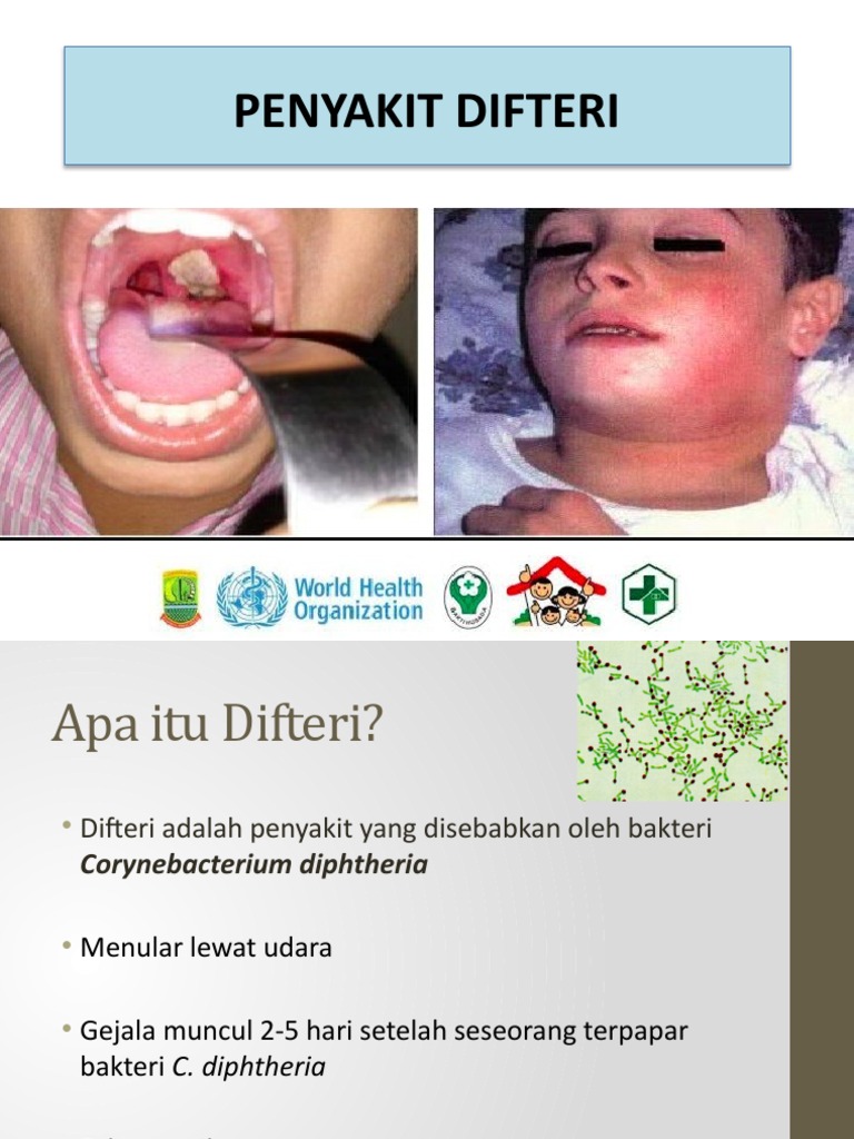 Panduan Lengkap Difteri: Gejala, Pengobatan, dan Pencegahan | PDF | Sains & Matematika