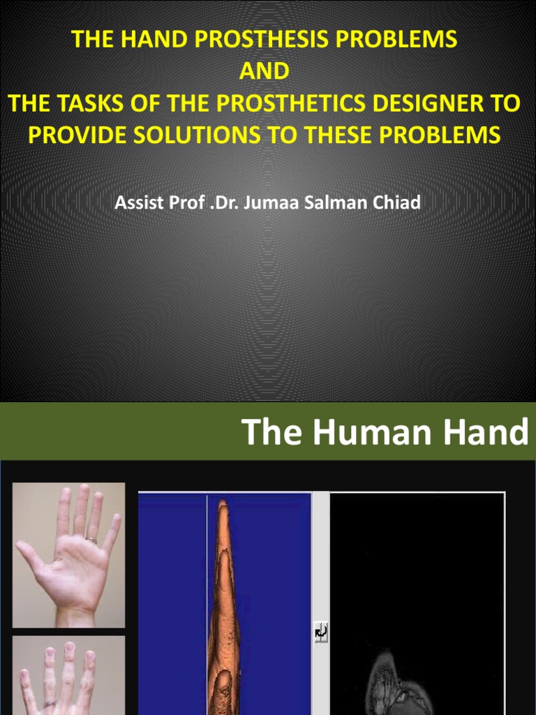 Prosthetic Hand Design Solutions | PDF | Prosthesis | Hand
