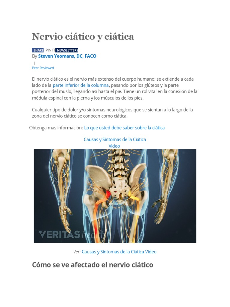 Nervio Ciático y Ciática | PDF | Nervio | Causas de la muerte