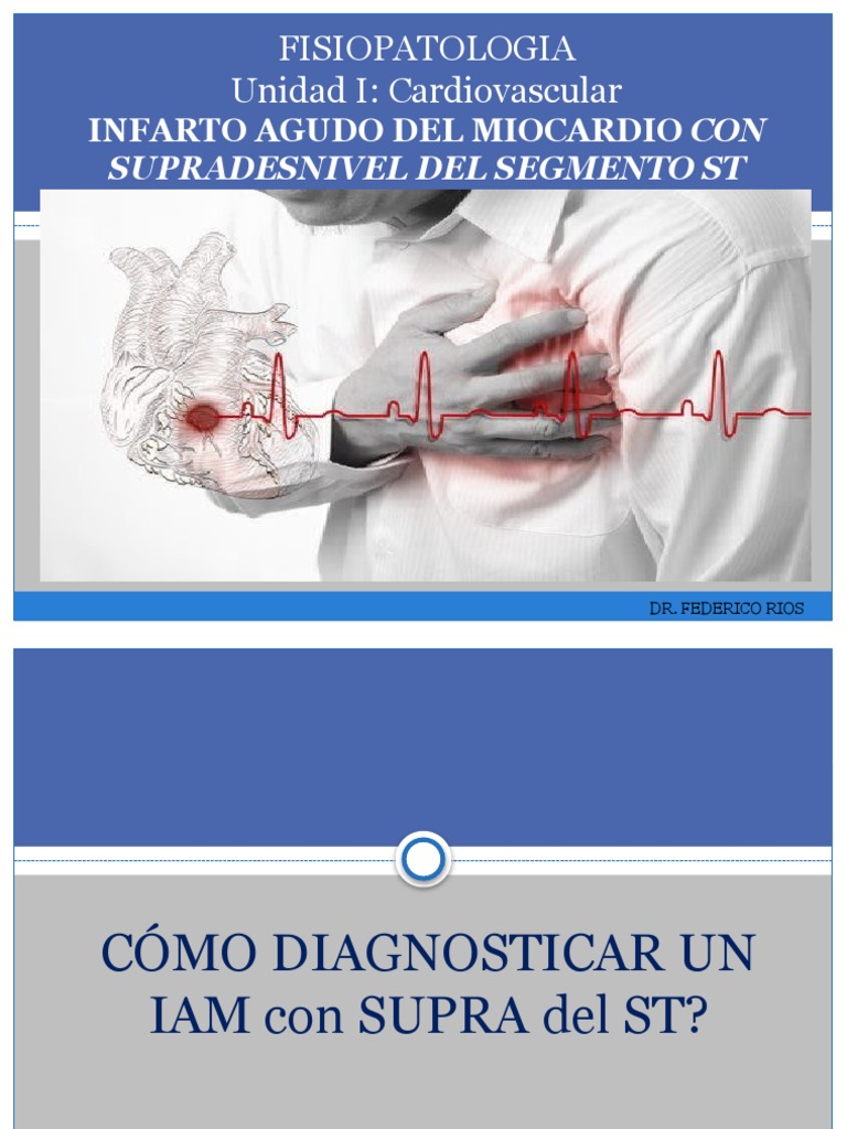 2.IAM Con Supra ST. | PDF | Infarto de miocardio | Enfermedades y ...