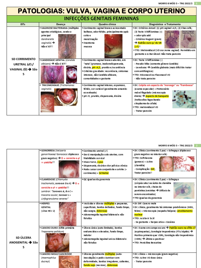 Tabela 1 M3 1VA - Patologias Vulva, Vagina e Corpo Uterino | PDF | Saúde pública | Urologia