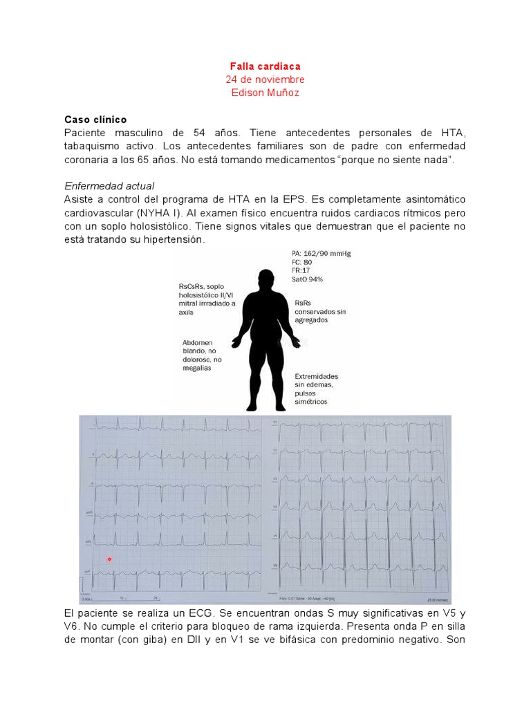 Falla Cardiaca | PDF | Insuficiencia cardíaca | Electrocardiografia