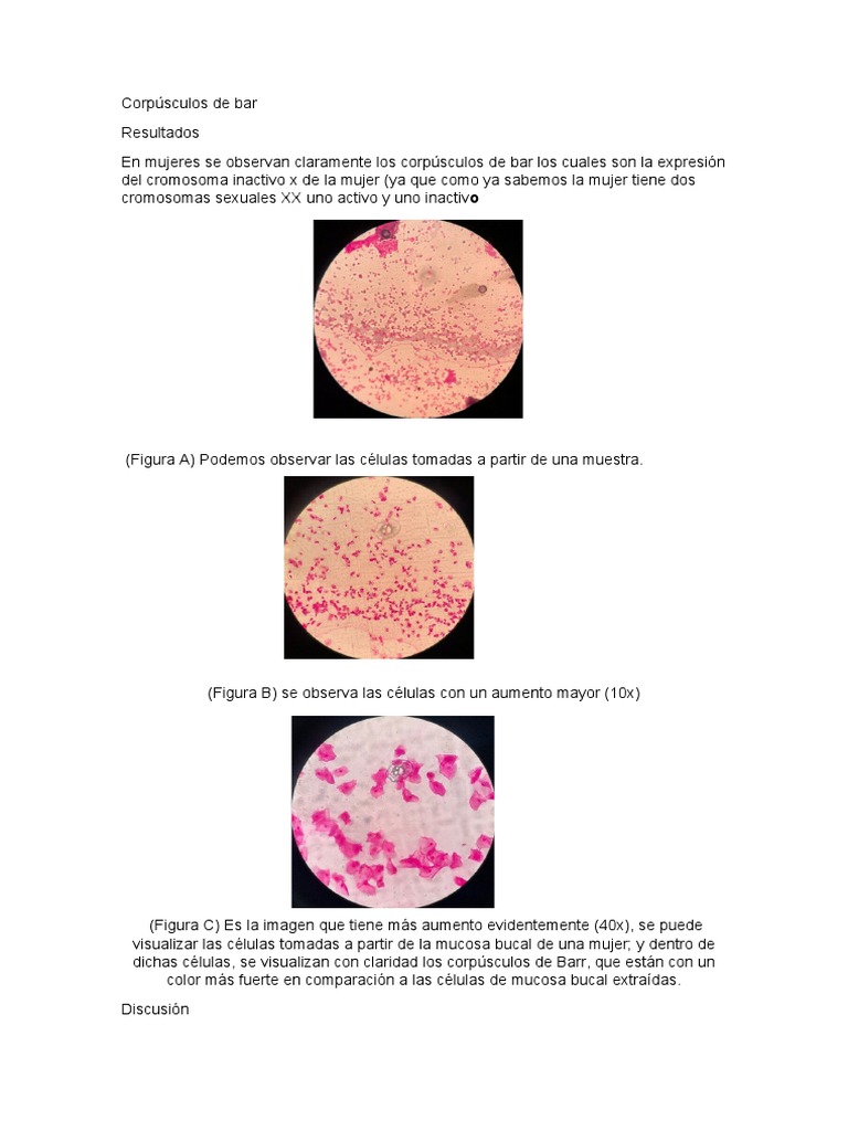 Corpúsculos de Barr en Mujeres y Hombres | PDF | Cromosoma | Biología