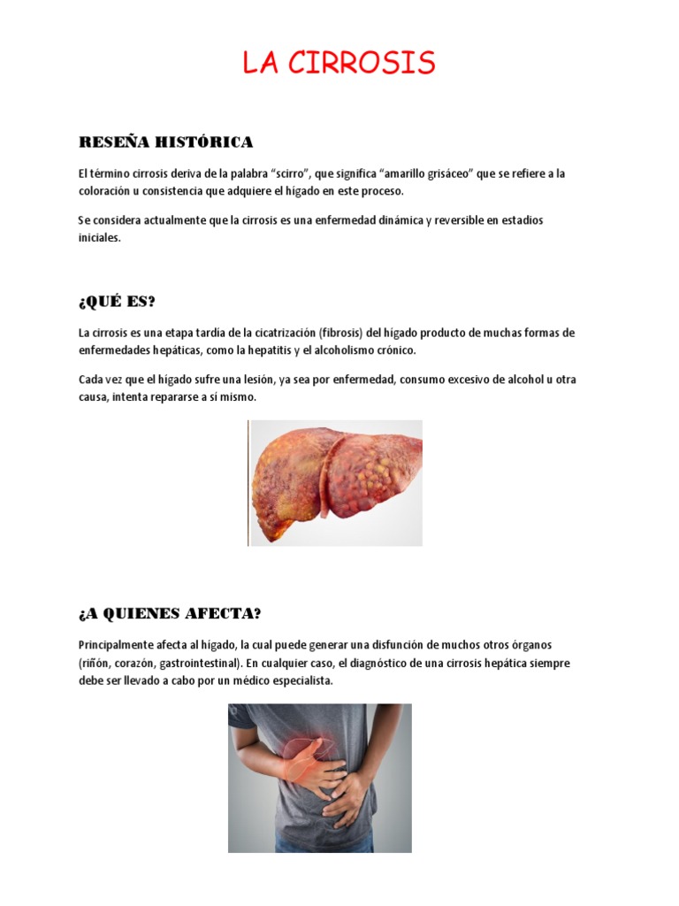 La Cirrosis 2 | PDF | Cirrosis | Hepatitis