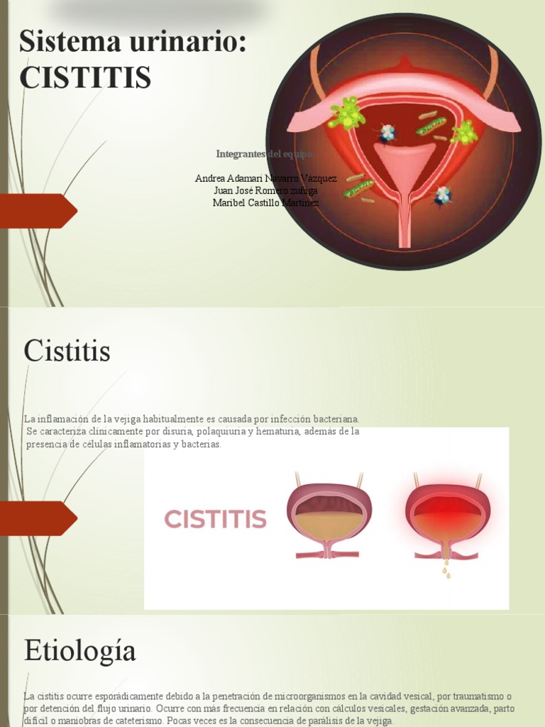 Etiología y síntomas de la cistitis | PDF | Infección del tracto ...