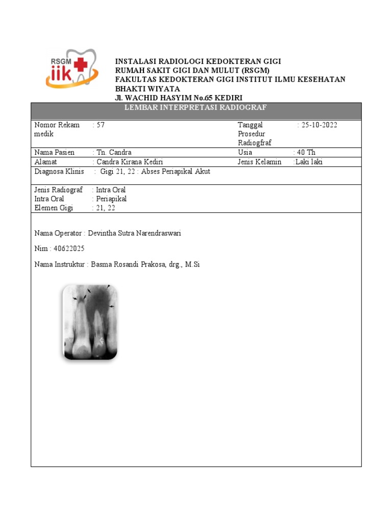 Interpretasi PERIAPIKAL Abses Periapikal | PDF