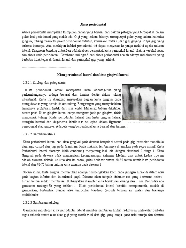 Kista Lateral Periodontal | PDF | Sains & Matematika | Kesehatan Holistik