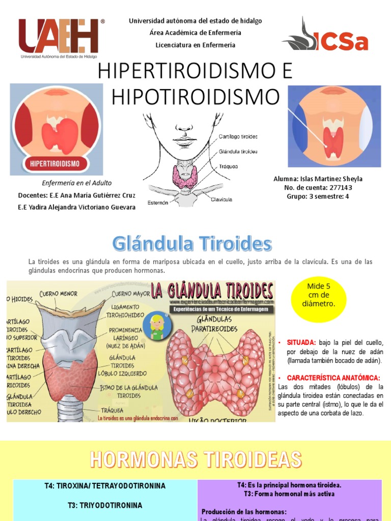 Hipertiroidismo e Hipotiroidismo | PDF | Tiroides | Hormona estimulante de la tiroides