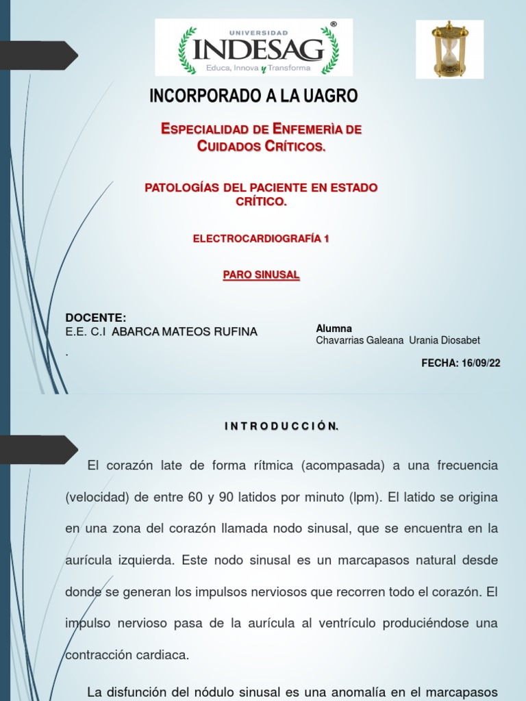 Paro Sinusal: Causas y Diagnóstico | PDF | Electrocardiografia | Causas ...
