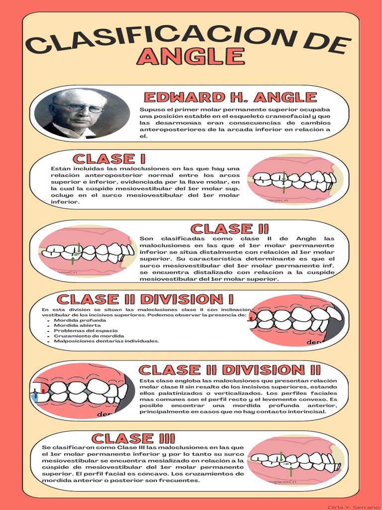 Clasificación de Angle: Clase II División II | PDF | Anatomia dental ...