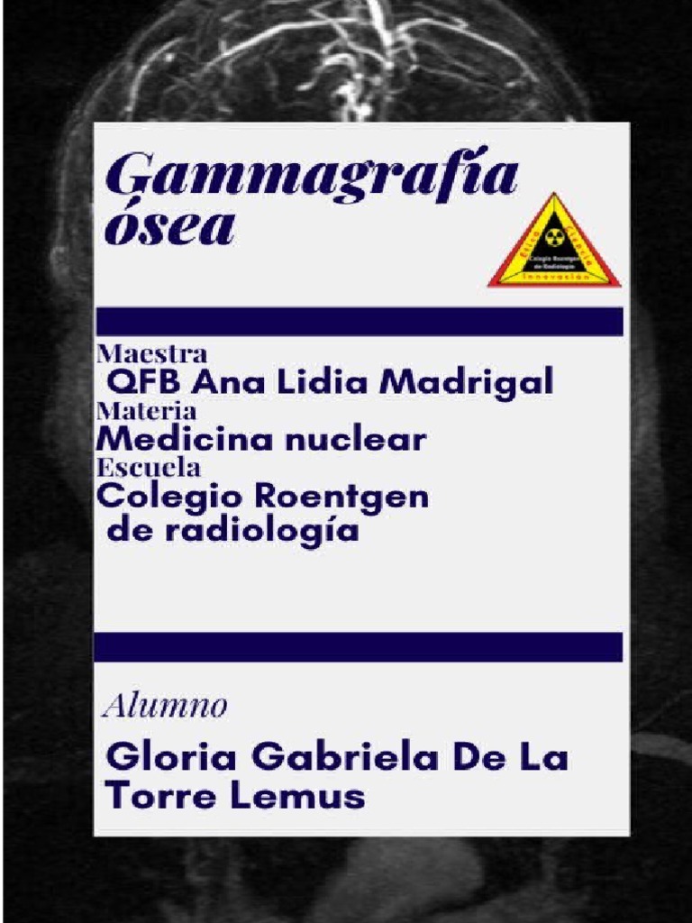 Gammagrafia Osea | PDF | Cáncer | Cáncer de pulmón