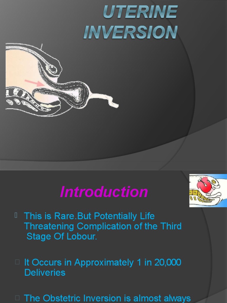 Inversion of Uterus 170225210149 | PDF | Uterus | Childbirth