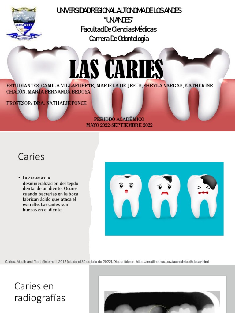 Caries | PDF | Esmalte de dientes | Diente