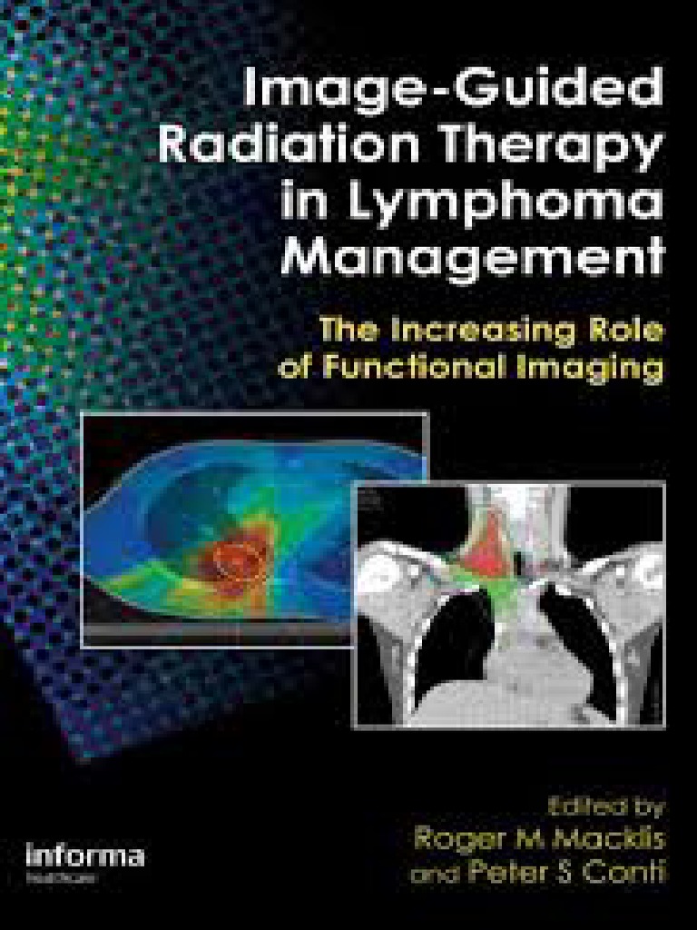 IGRT Lymphoma Managment | PDF | Positron Emission Tomography ...