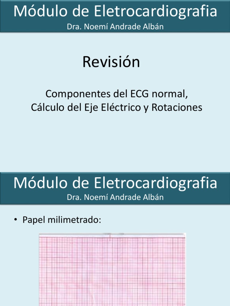 Ekg Normal | PDF | Electrocardiografia | Pruebas medicas