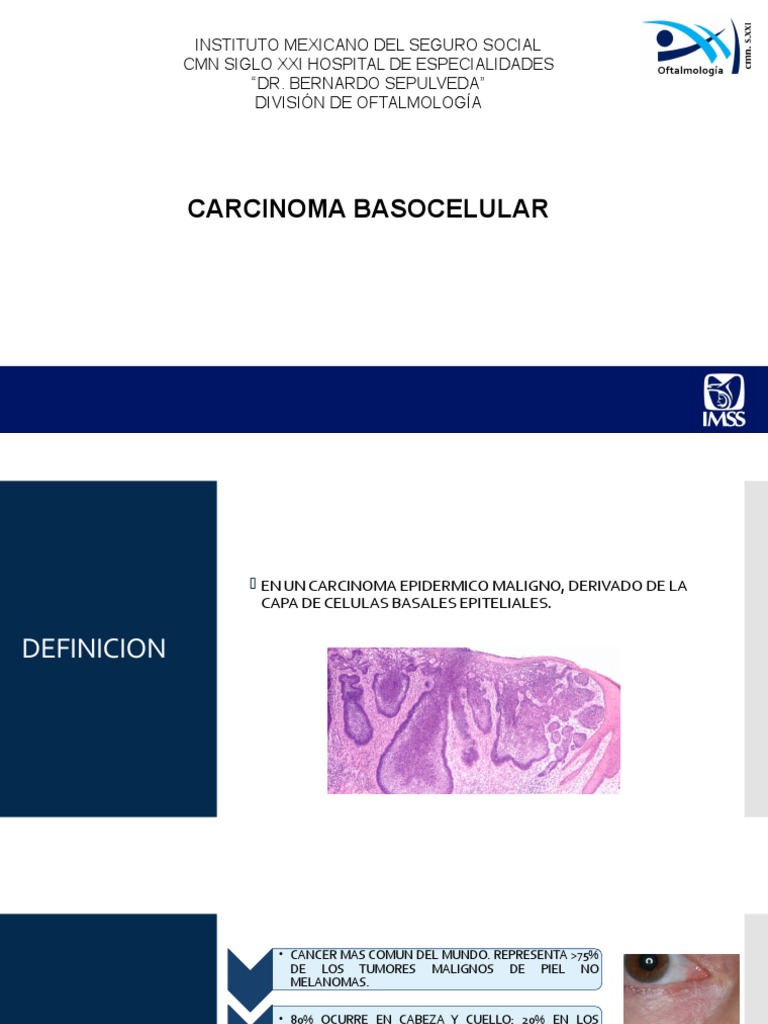 CA Basocelular | PDF | Cáncer | Medicina CLINICA