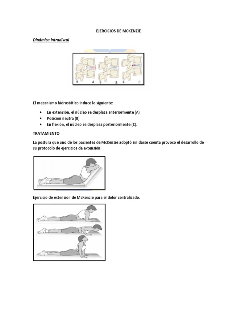 Ejercicios de Mckenzie | PDF