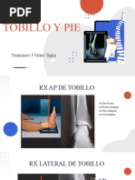 Anatomía Radiográfica Del Pie | PDF