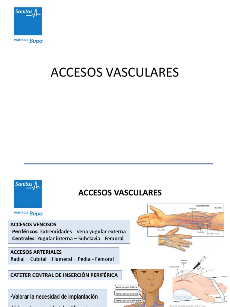 06 - Accesos Vasculares | PDF | Vena | Trombo