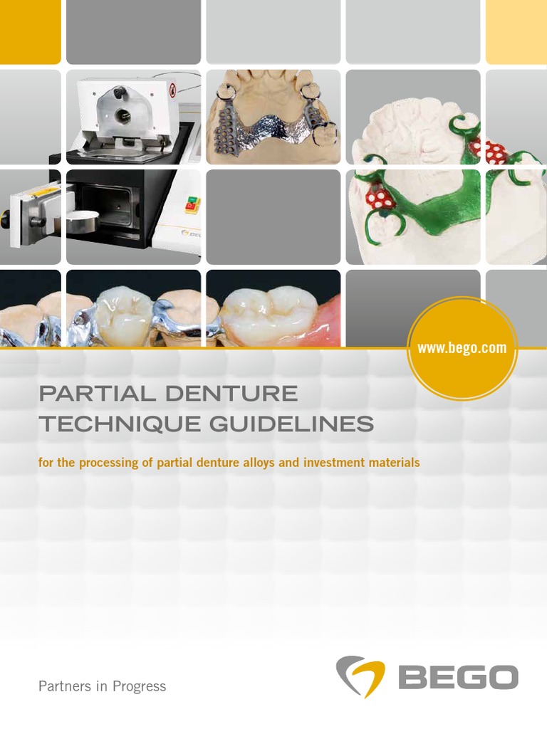 Cast Partial Favrication | PDF | Casting (Metalworking) | Dentures