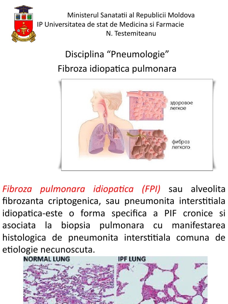 Disciplina "Pneumologie" Fibroza Idiopatica Pulmonara | PDF | Respiration | Clinical Medicine