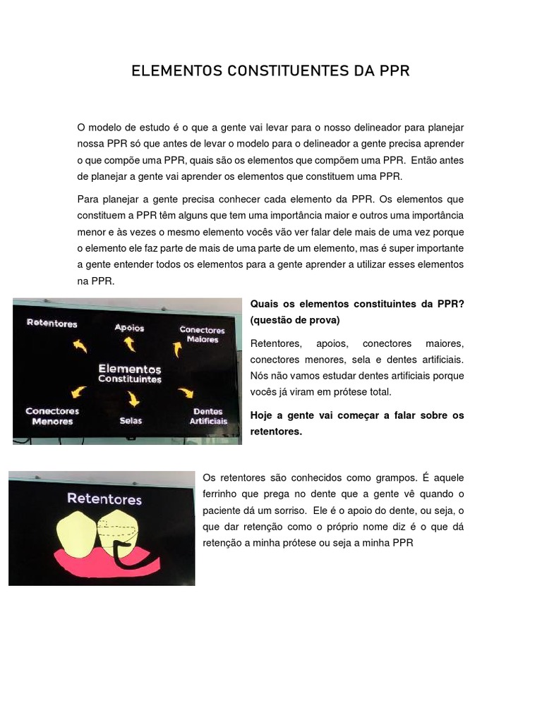Elementos Constituentes Da PPR | PDF | Prótese | Dente