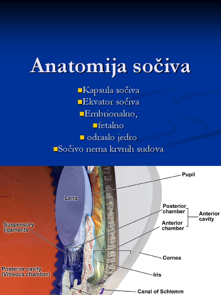 Sociva I Katarakta | PDF