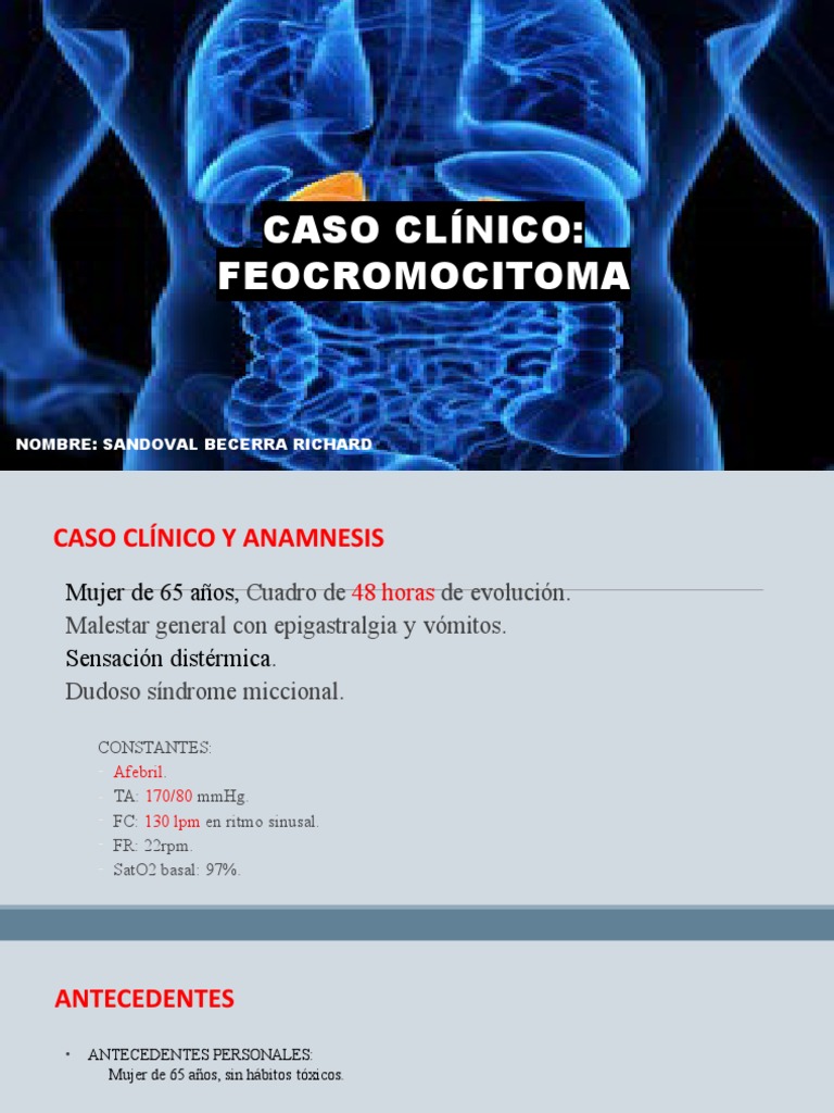 Caso Clinico (Feocromocitoma) | PDF | Causas de la muerte | Medicina CLINICA