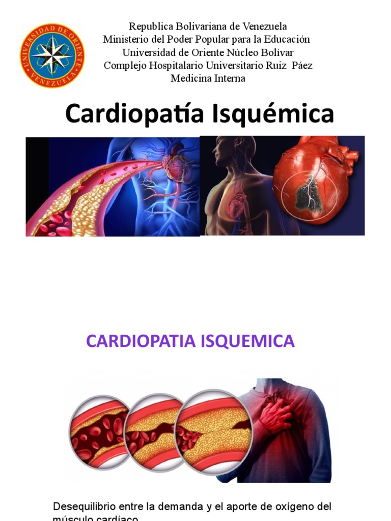 Cardiopatía. Isquémica.2021 | PDF | Infarto de miocardio | Isquemia