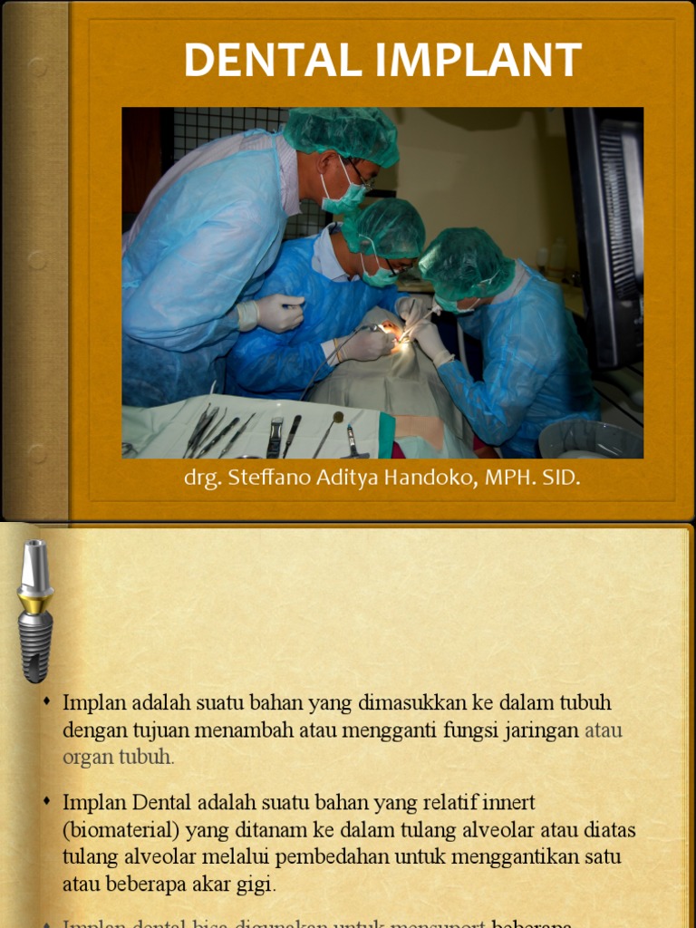 Dental Implant | PDF