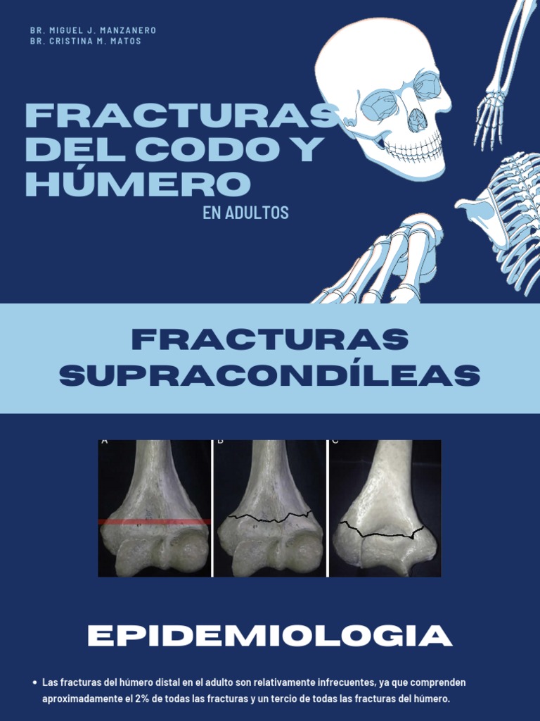 Fracturas de Húmero | PDF | Codo | Hombro