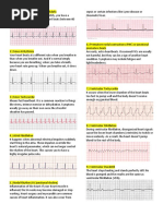 ECG Interpretation Cheat Sheet | PDF | Electrocardiography | Artificial ...