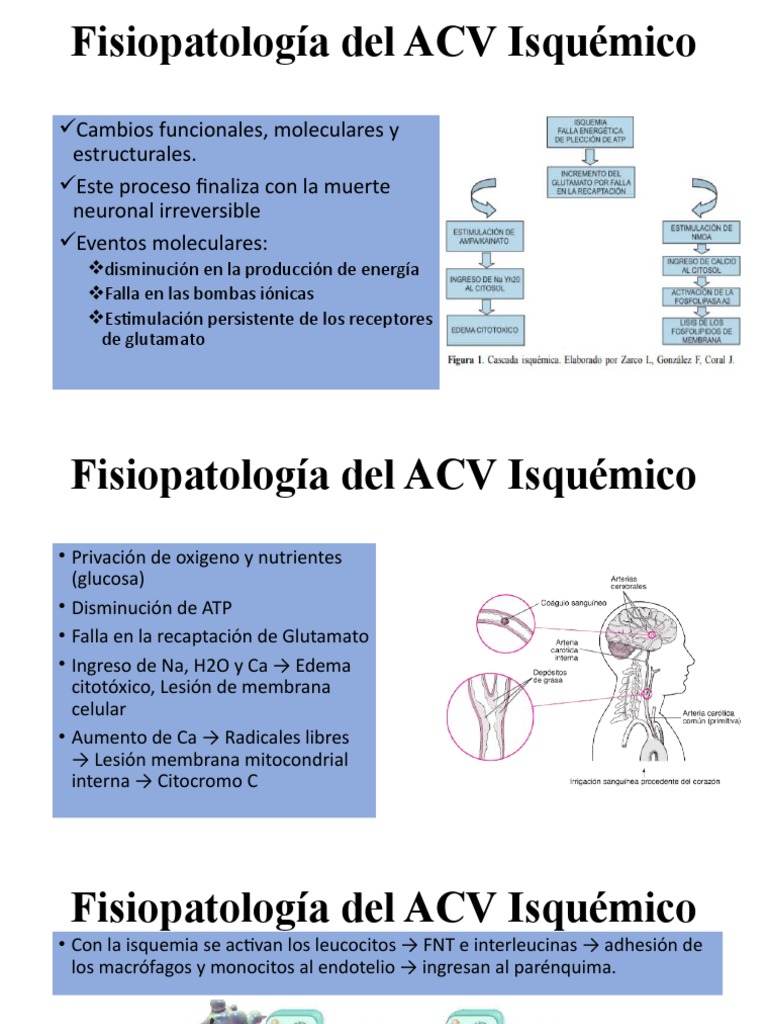 Fisiopatología Del ACV Isquémico | PDF