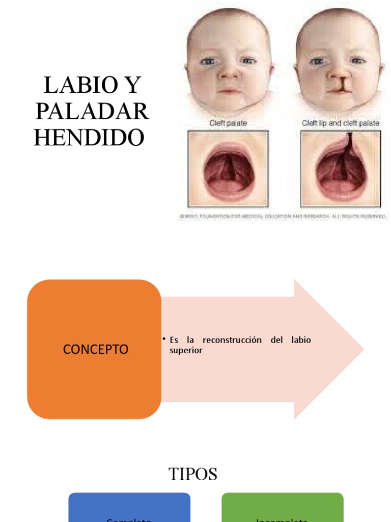 Día Internacional del Labio Hendido | PDF | Cirugía | Anatomía humana