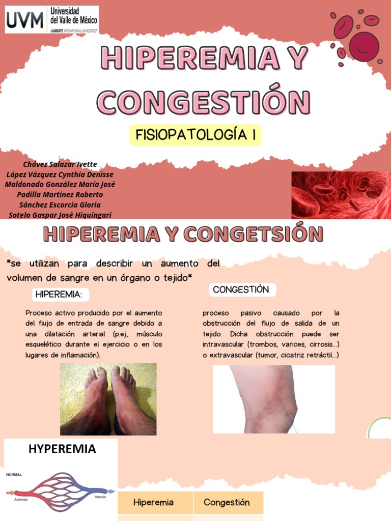 Hiperemia y Congestion | PDF | Vena | Inflamación