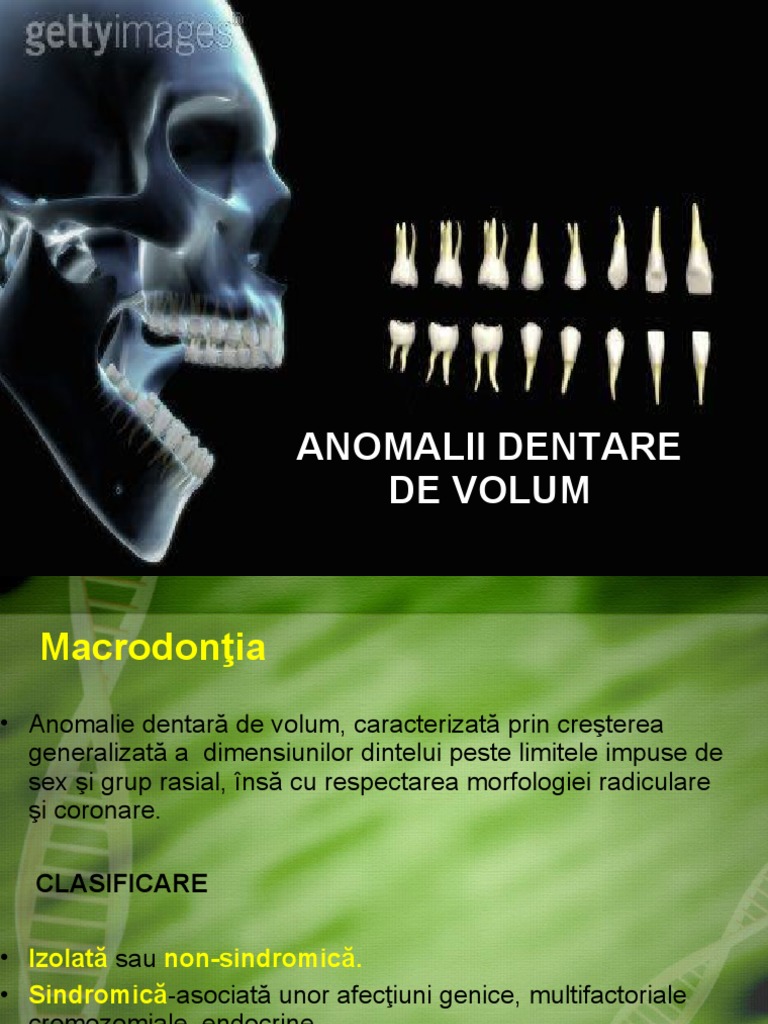 Anomalii Dentare de Volum | PDF