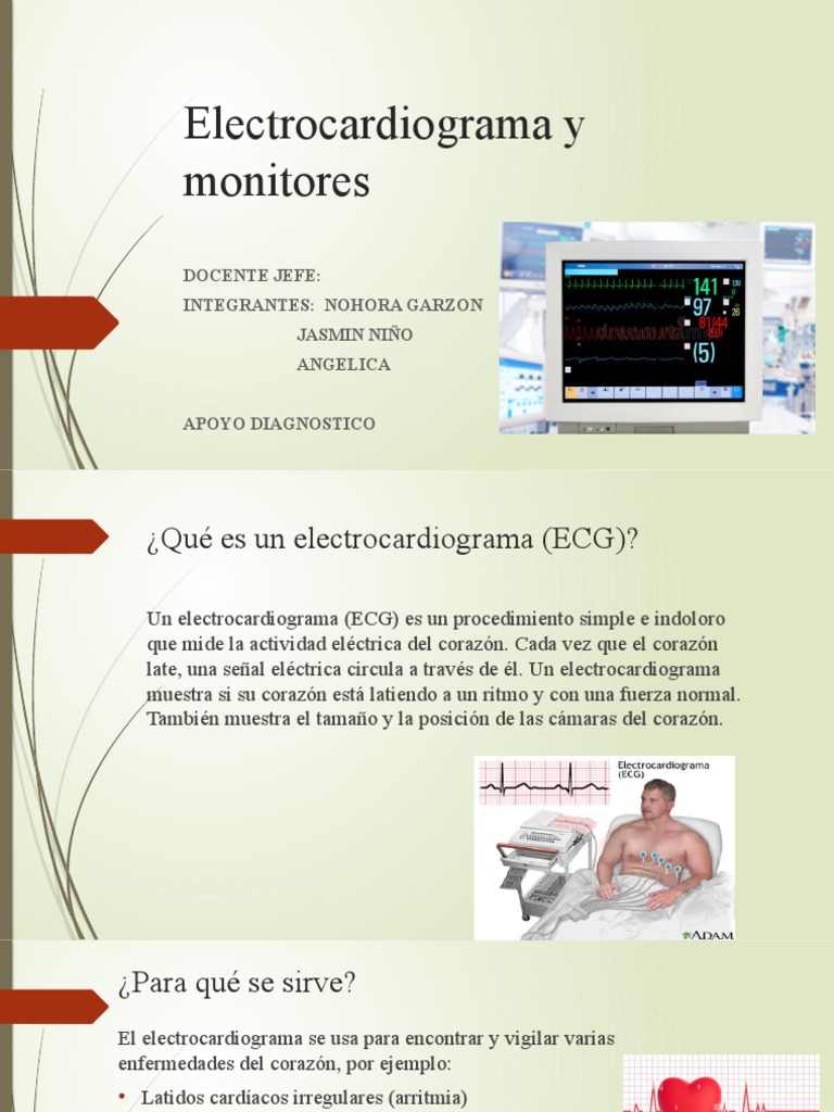 Electrocardiogramas, monitores cardiacos y de signos vitales: usos ...