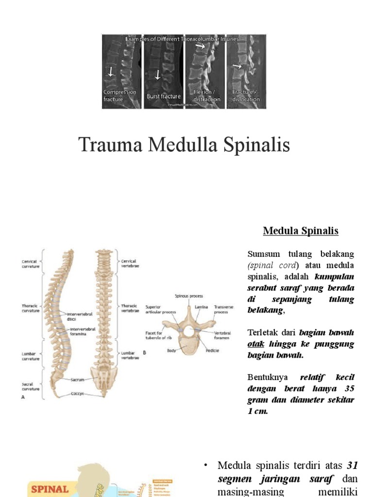 Trauma Medula Spinalis | PDF