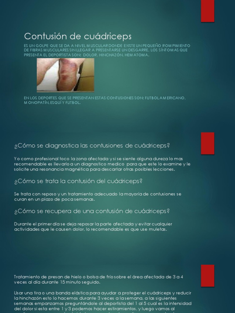 Contusión de Cuádriceps | PDF
