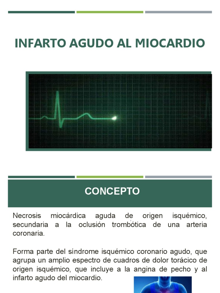 Infarto Agudo de Miocardio | PDF | Infarto de miocardio ...