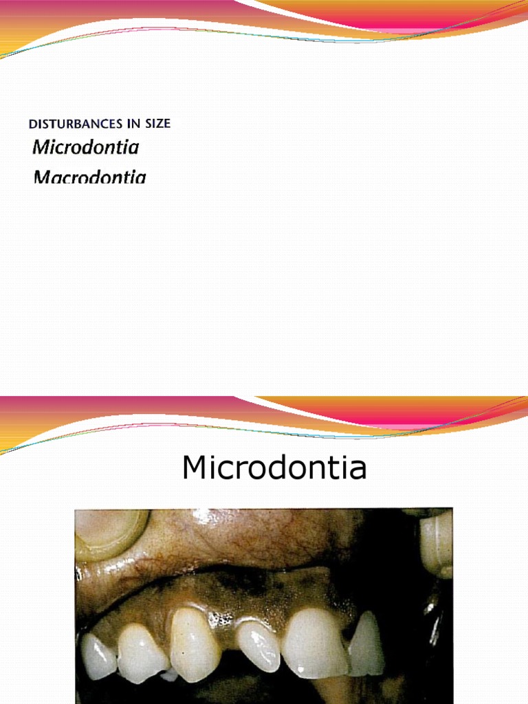 1.disorders of Development of Teeth | PDF