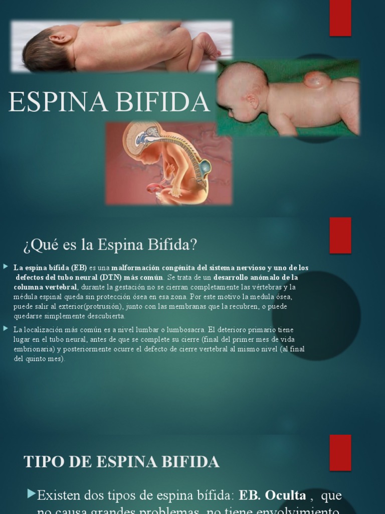 Espina Bifida - Presentacion | PDF | Sistema nervioso | Medicina